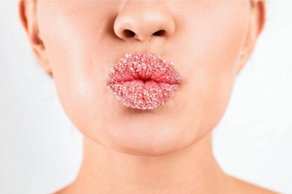 Bintik Putih di Bibir: Penyebab dan Cara Mengatasi | Popbela.com